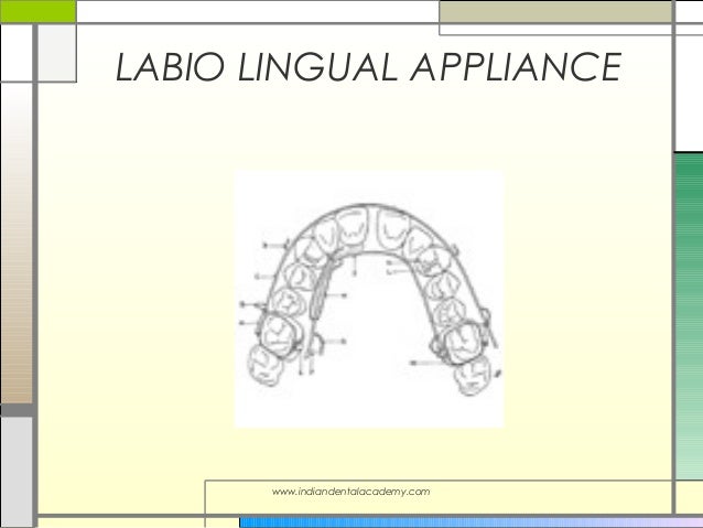 Development of contemporary fixed appliance /certified fixed orthodon…