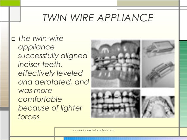Development of contemporary fixed appliance /certified fixed orthodon…