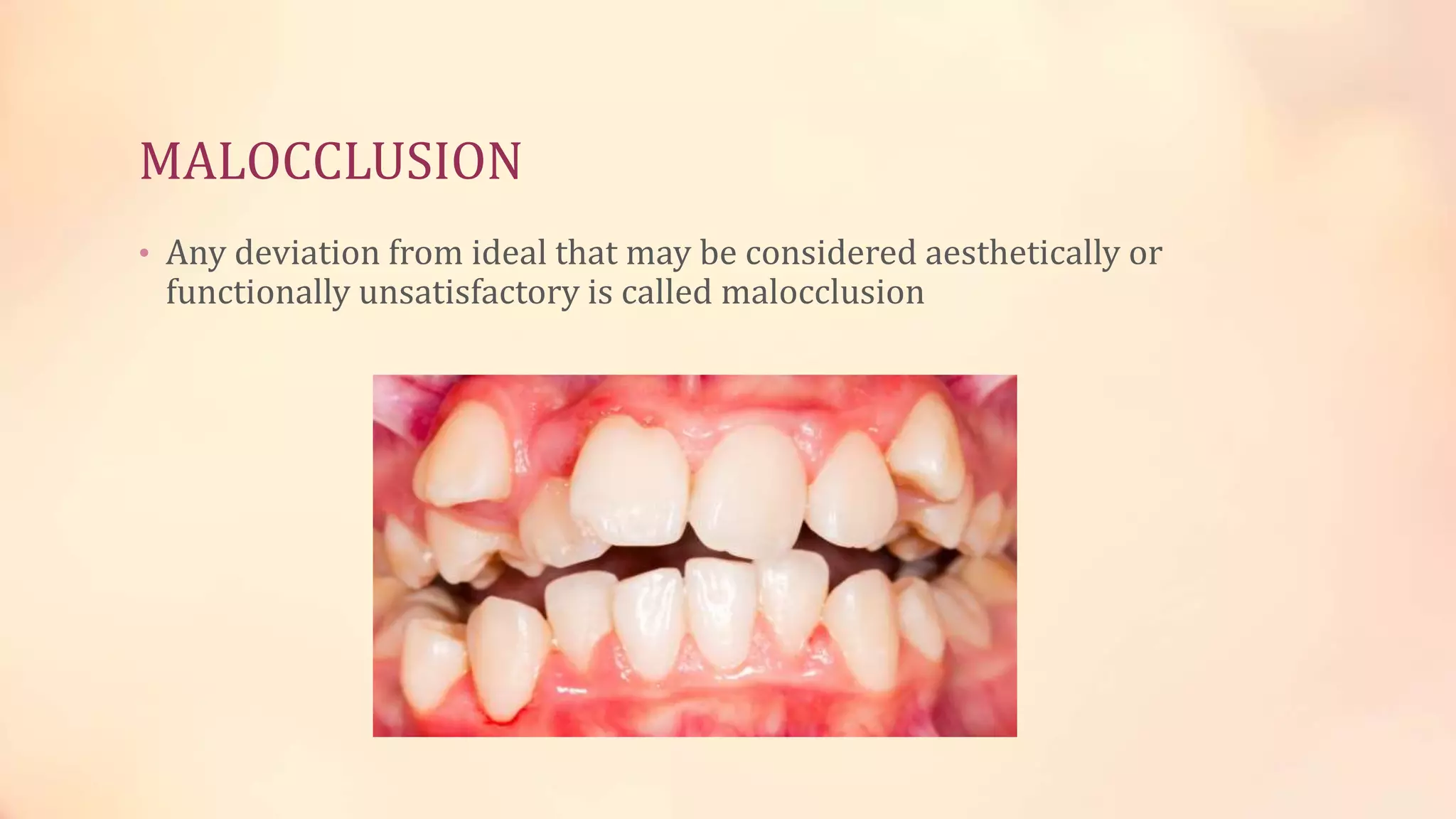 Development of dental occlusion in orthodontics | PPTX