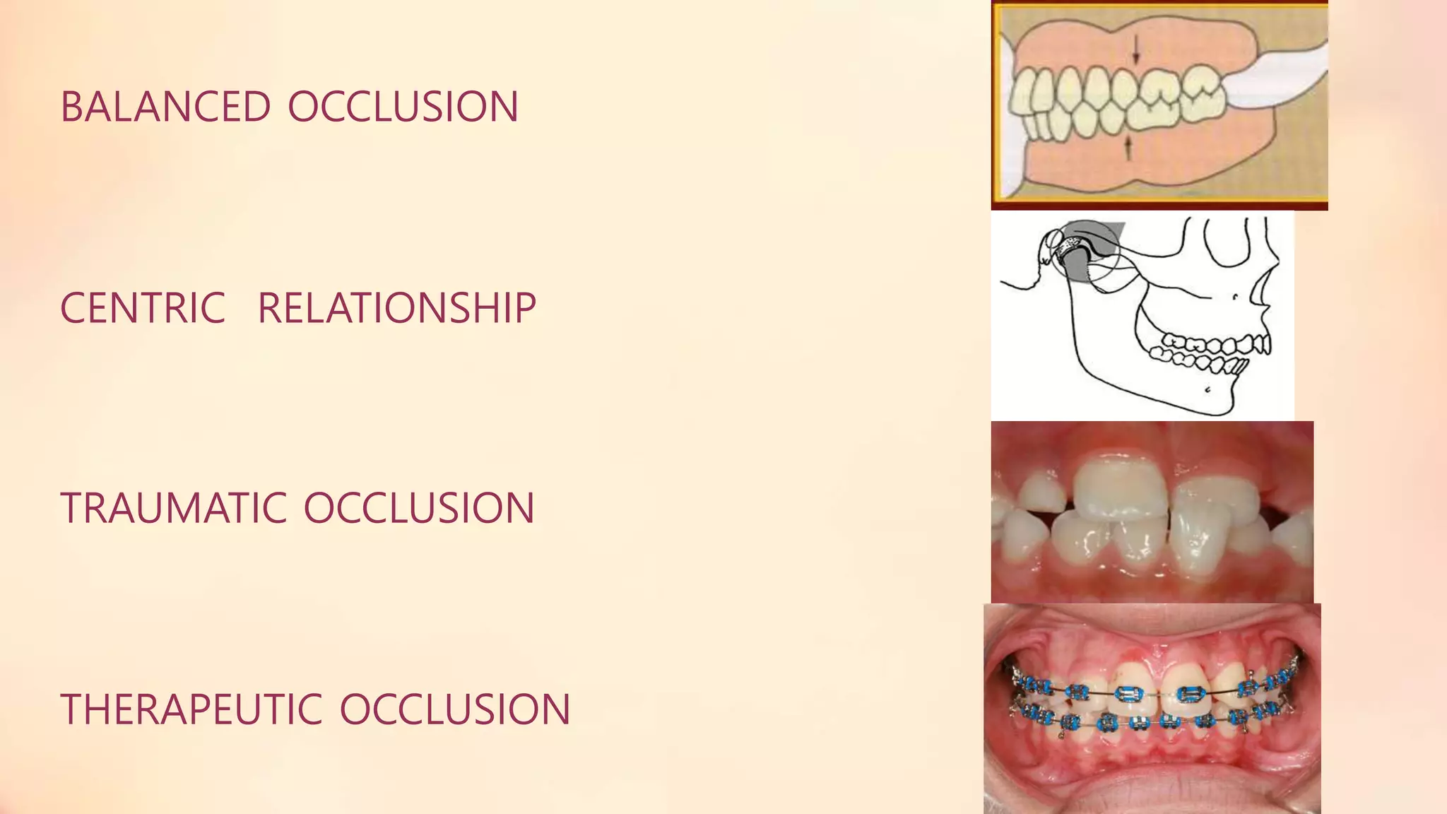 Development of dental occlusion in orthodontics | PPTX