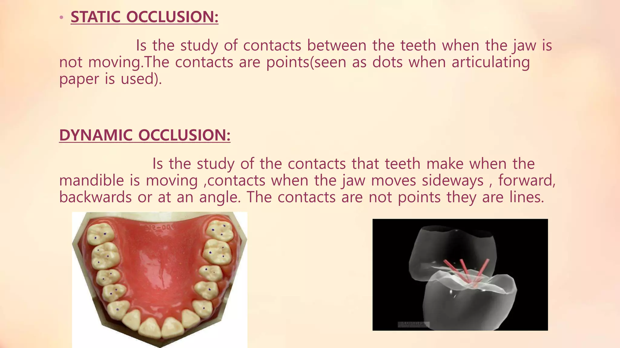 Development of dental occlusion in orthodontics | PPTX