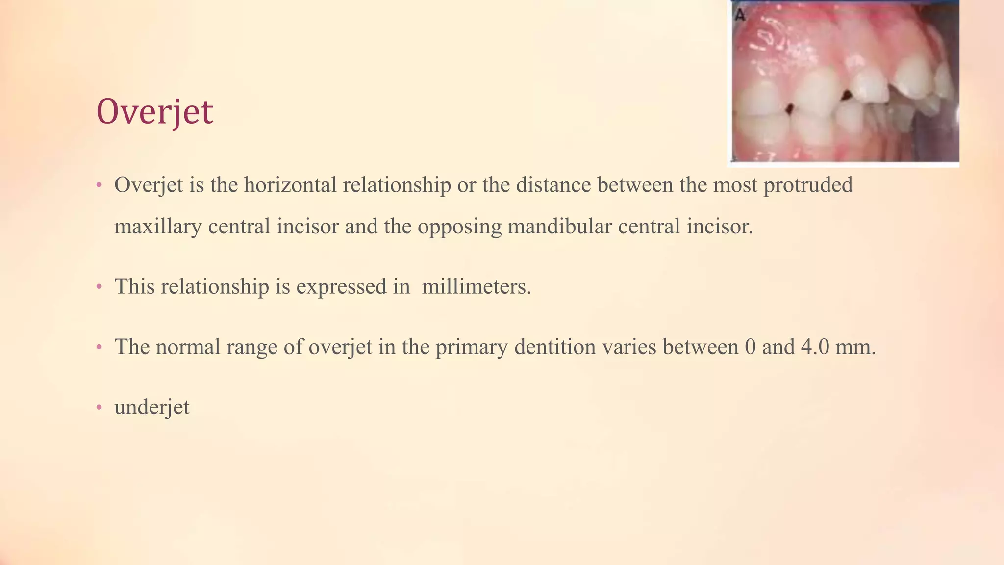 Development of dental occlusion in orthodontics | PPTX