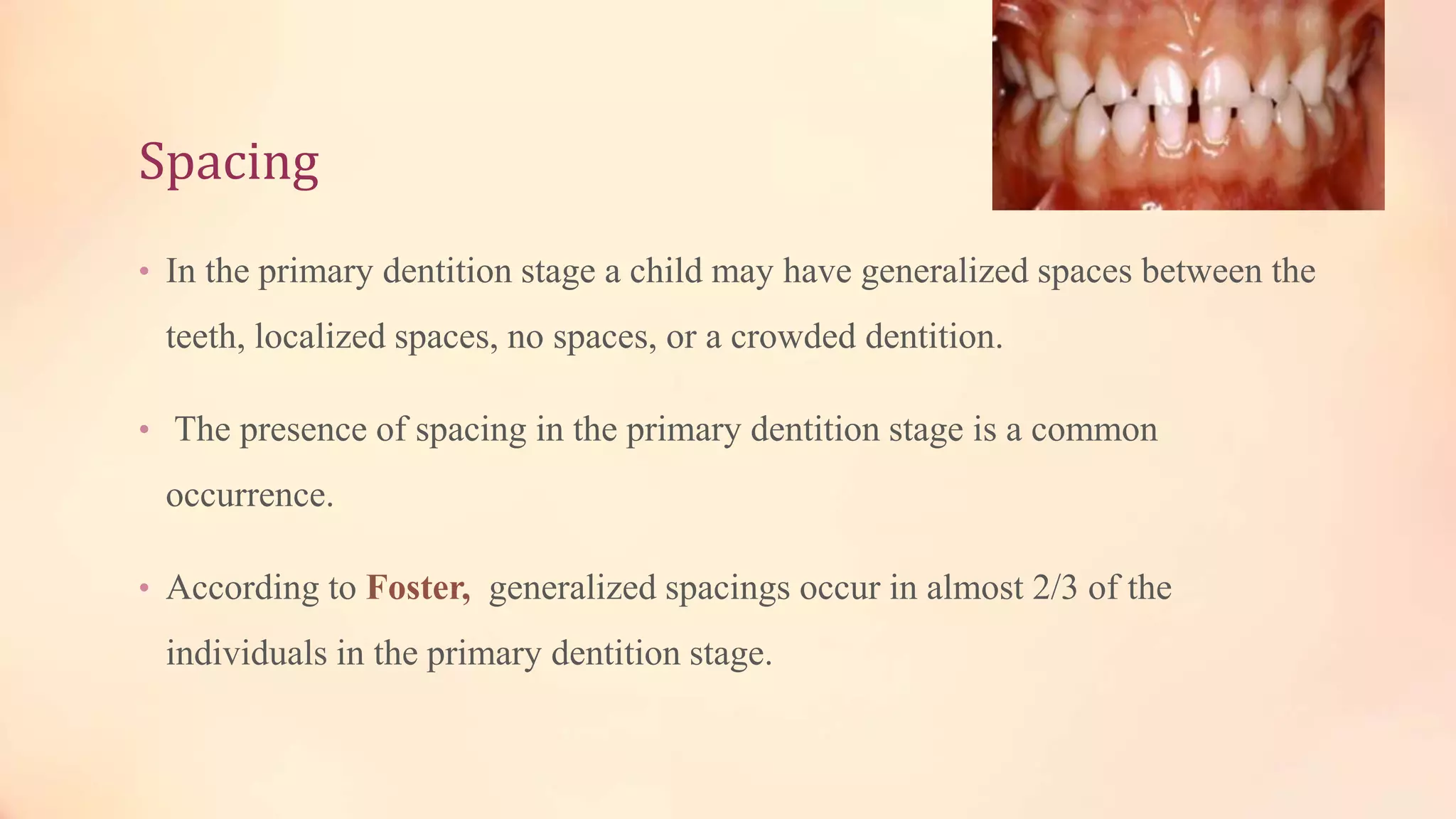 Development of dental occlusion in orthodontics | PPTX