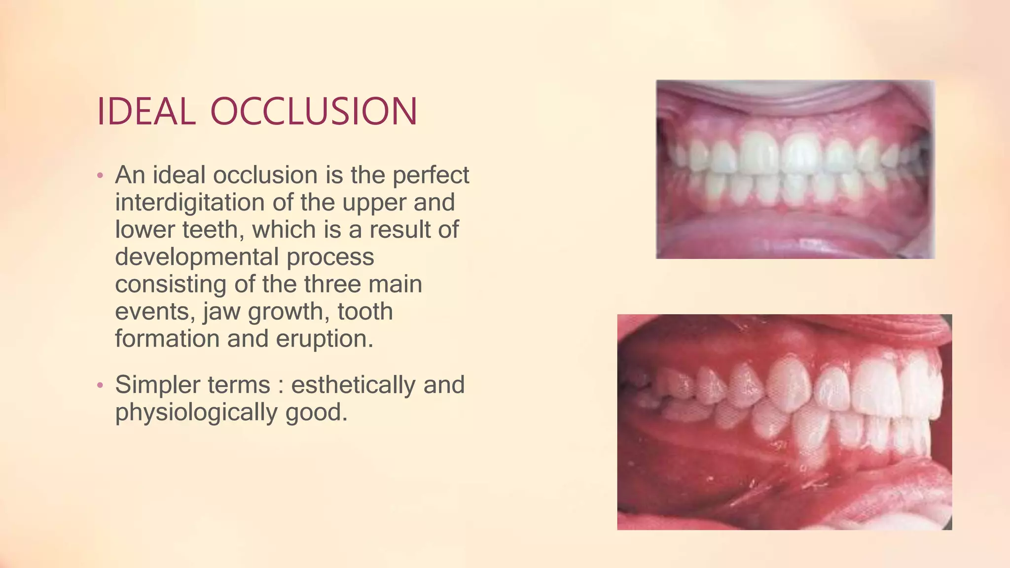 Development of dental occlusion in orthodontics | PPTX