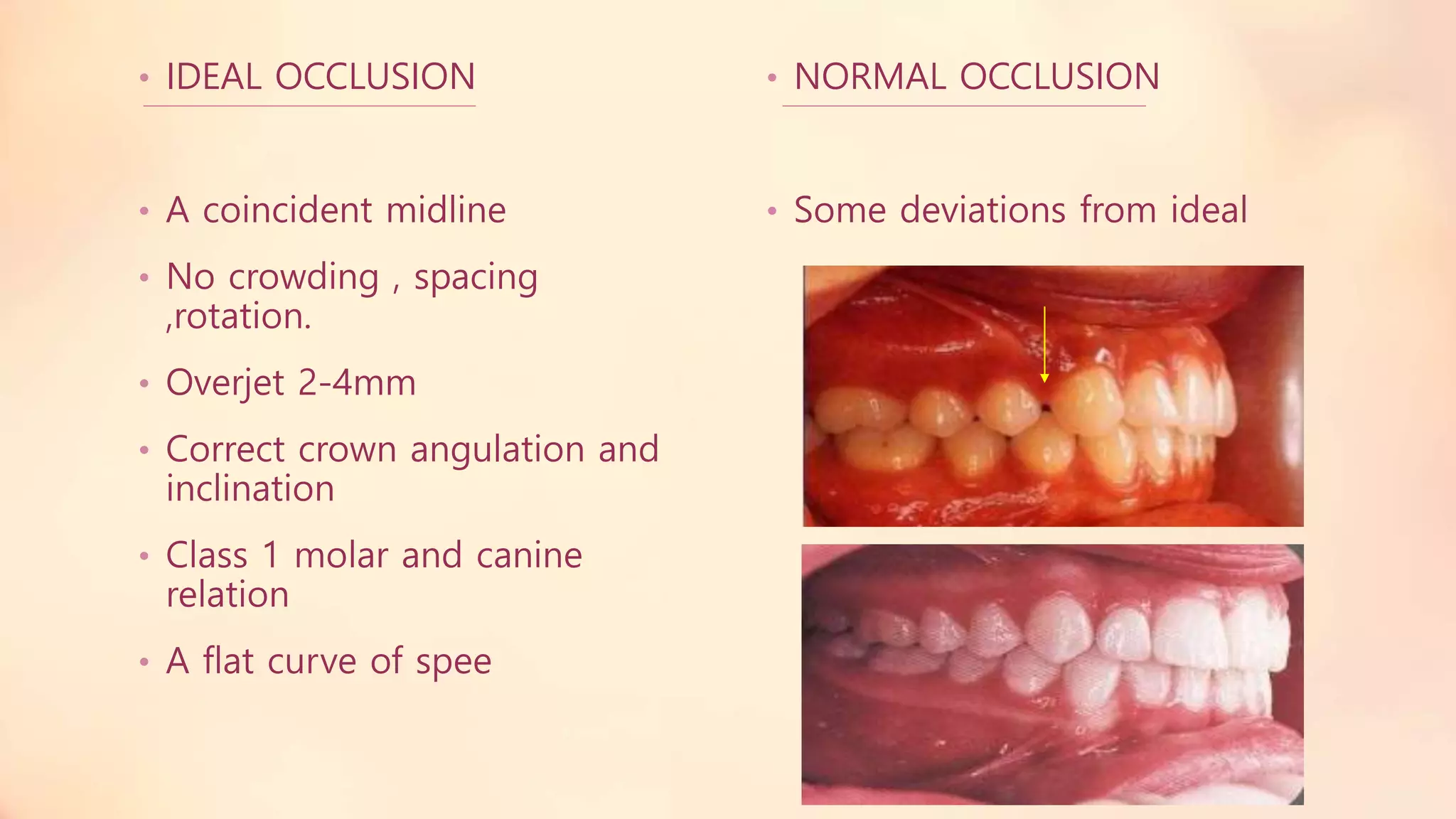 Development of dental occlusion in orthodontics | PPTX