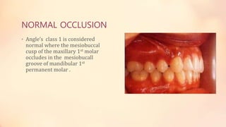 Development of dental occlusion in orthodontics | PPTX