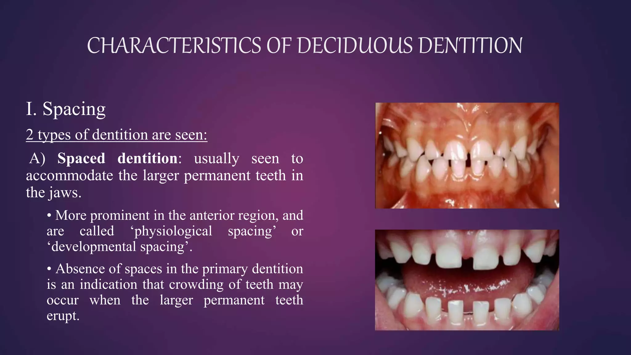Development of dentition and occlsion | PPTX