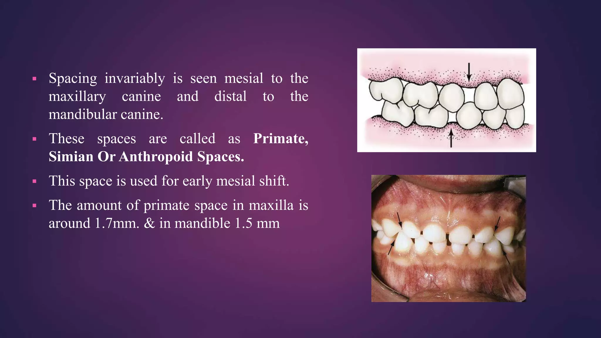 Development of dentition and occlsion | PPTX