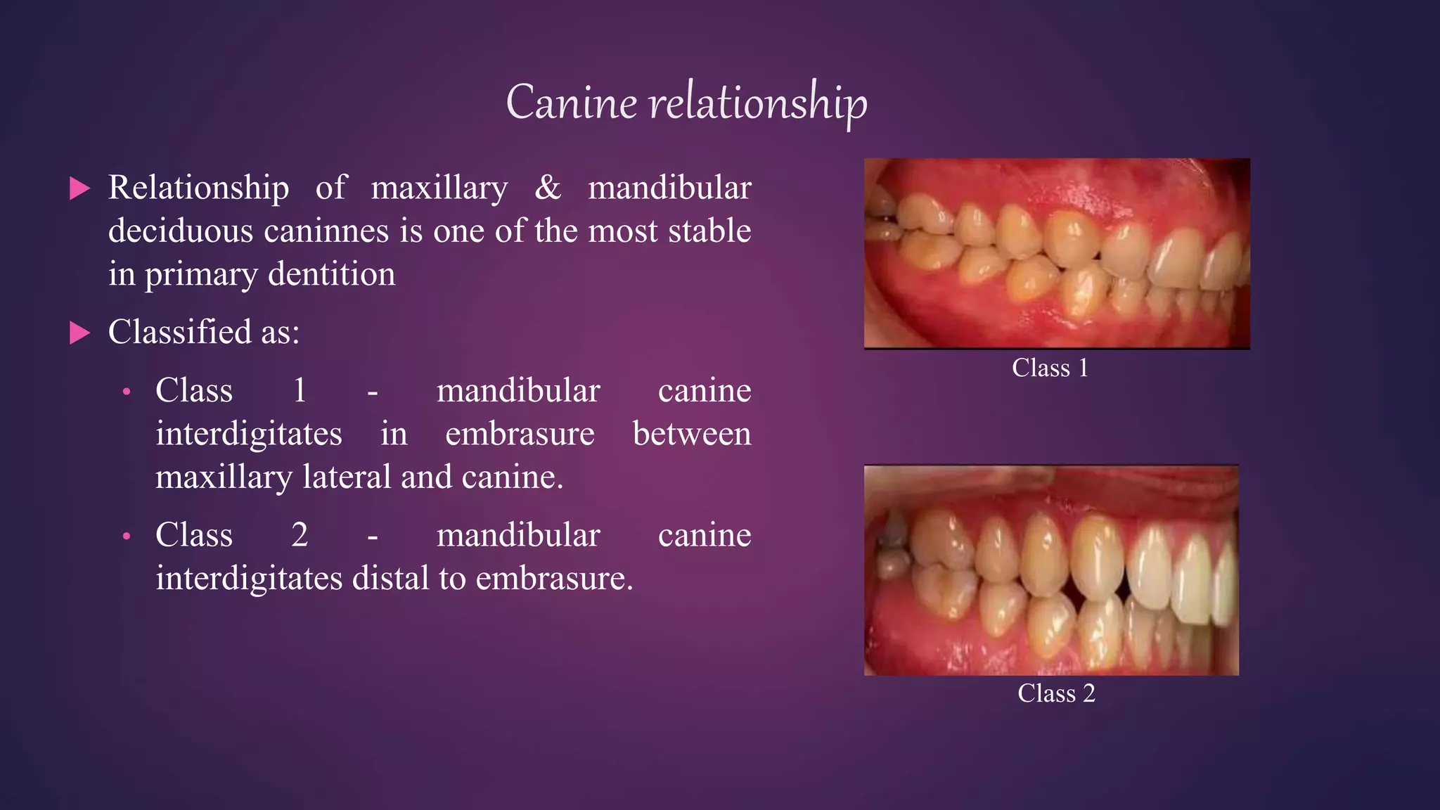Development of dentition and occlsion | PPTX