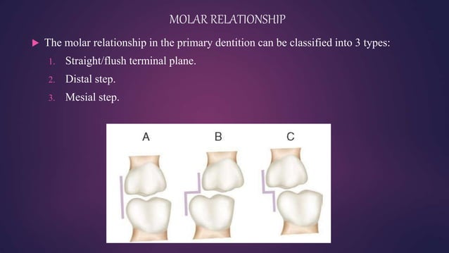 Development of dentition and occlsion | PPTX | Dental Health | Diseases ...