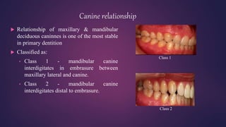 Development of dentition and occlsion | PPTX