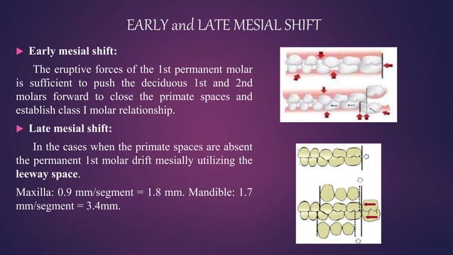 Development of dentition and occlsion | PPTX | Dental Health | Diseases ...