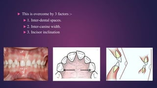 Development of dentition and occlsion | PPTX