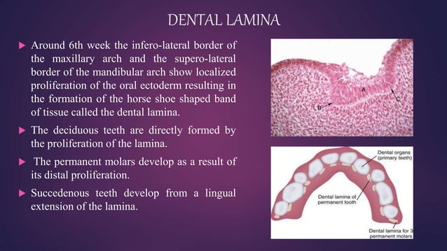 Development of dentition and occlsion | PPTX | Dental Health | Diseases ...