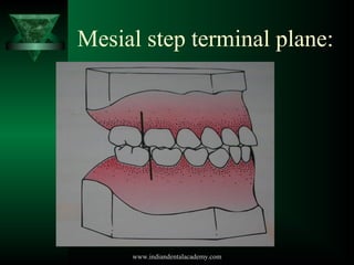 Development of dentition and occlusion /certified fixed orthodontic ...