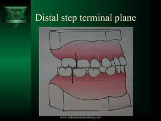 Development of dentition and occlusion /certified fixed orthodontic ...