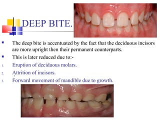 Development of dentition and occlusion | PPT