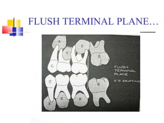 Development of dentition and occlusion | PPT