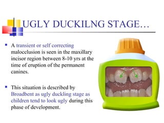 Development of dentition and occlusion | PPT