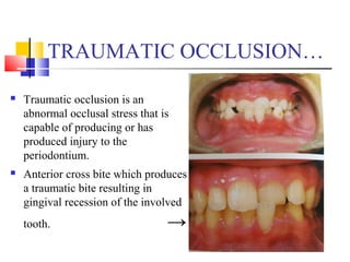 Development of dentition and occlusion | PPT