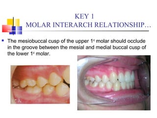 Development of dentition and occlusion | PPT
