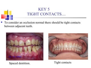 Development of dentition and occlusion | PPT