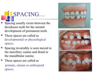 Development of dentition and occlusion | PPT