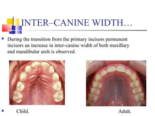 Development of dentition and occlusion | PPT