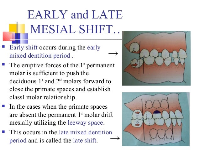 Development of dentition and occlusion