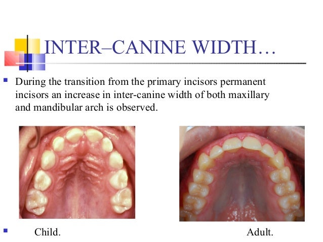 Development of dentition and occlusion