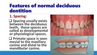 Development of dentition and occlusion | PPTX
