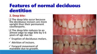 Development of dentition and occlusion | PPTX