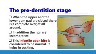 Development of dentition and occlusion | PPTX