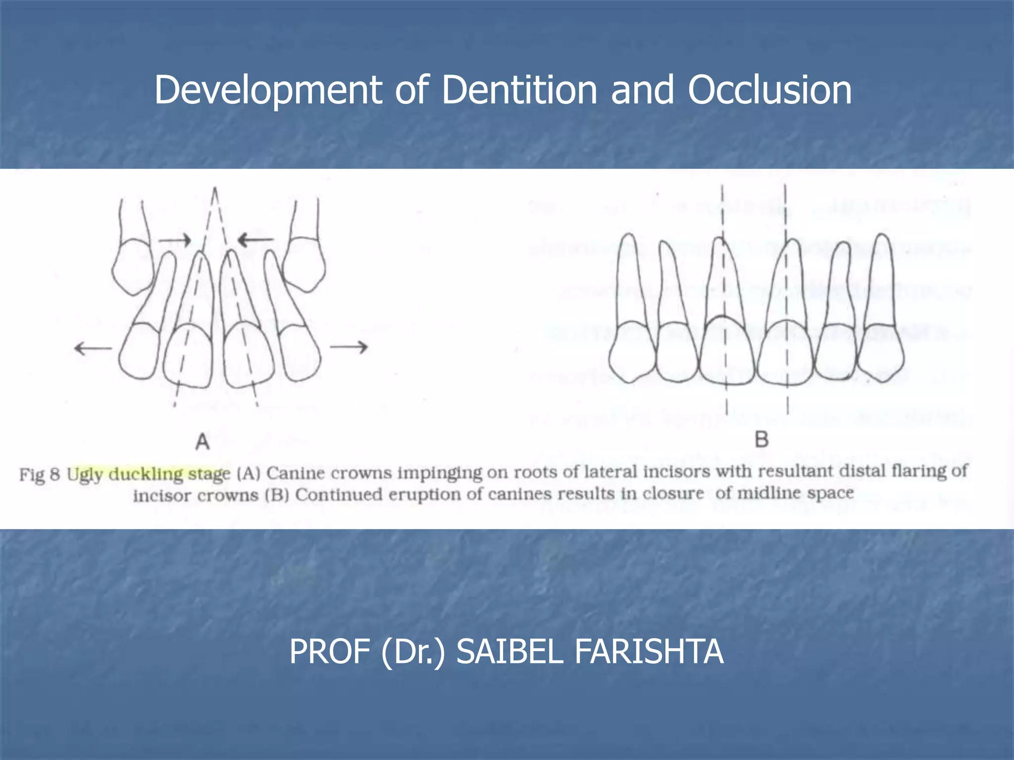 Development of dentition and occlusion | PPT