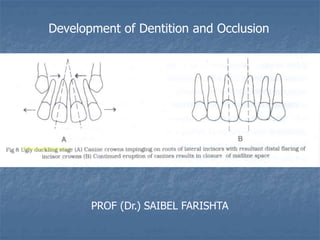 Development of dentition and occlusion | PPT