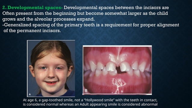 Development of dentition by Sourav Guinpptx | PPT