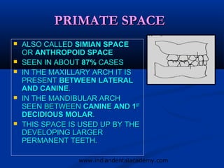 Development of dentition & occlusion / /certified fixed orthodontic ...