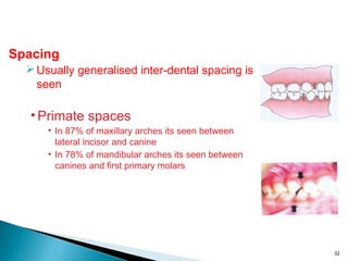 Development of dentiton and occlusion dr ajay srinivas | PPT