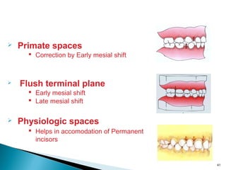 Development of dentiton and occlusion dr ajay srinivas | PPT