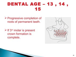 Development of dentiton and occlusion dr ajay srinivas | PPT