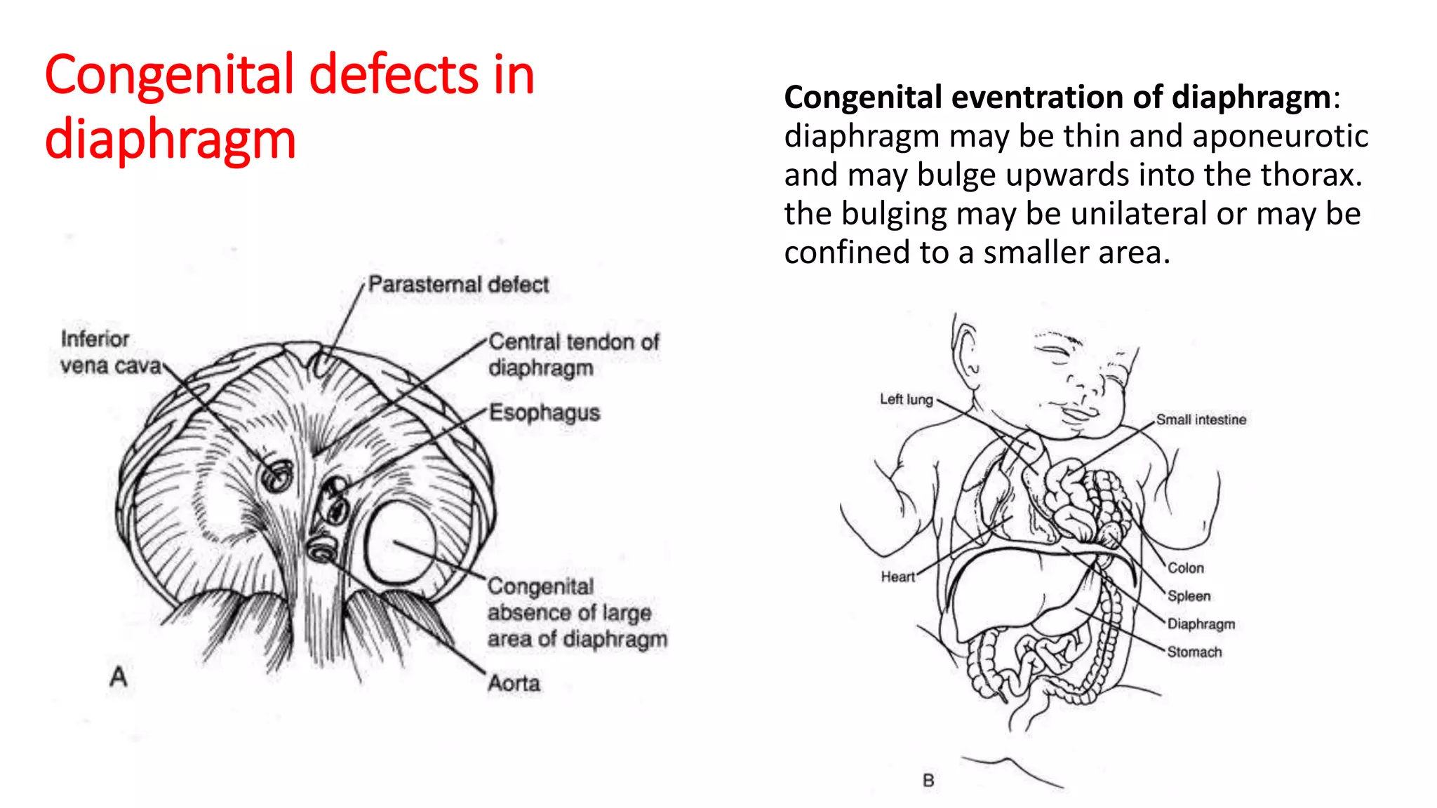 Development of Diaphragm.pptx