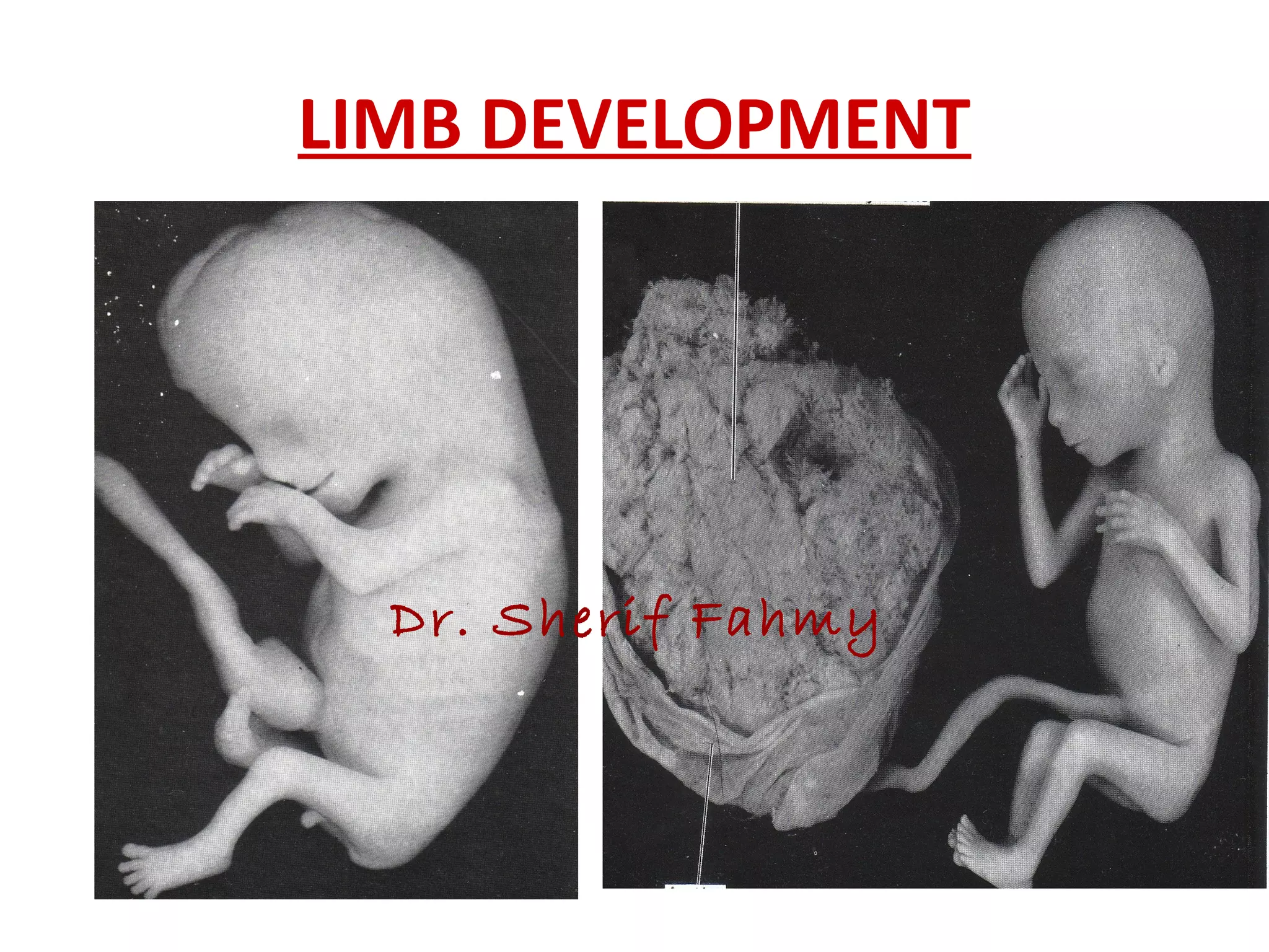 Development of Diaphragm, Skull, Vertebrae & Limbs (Special Embryology ...