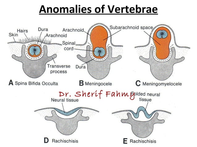 Development of Diaphragm, Skull, Vertebrae & Limbs (Special Embryology ...
