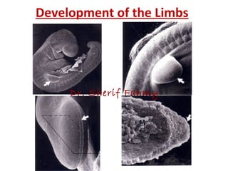 Development of Diaphragm, Skull, Vertebrae & Limbs (Special Embryology ...