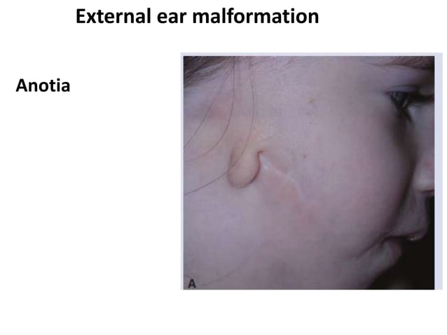 Development of Ear | PPTX