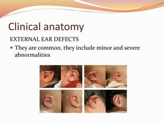 Development of ear | PPTX