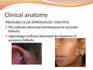 Development of ear | PPTX