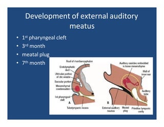Development of ear.pdf Development of the Ear The ear develops from ...