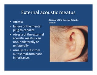 Development of ear.pdf Development of the Ear The ear develops from ...