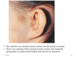 Embryological Development of ear ear.ppt